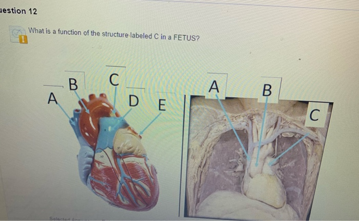 Solved If you had an oxygen molecule in the vessel labeled | Chegg.com