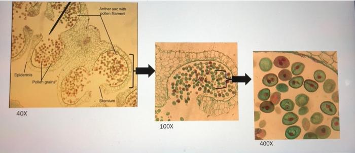 Solved 1.Describe the structure of the lily pollen (@400x) | Chegg.com