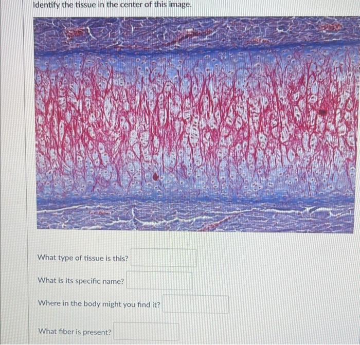 Solved Identify the tissue in the center of this image. What | Chegg.com