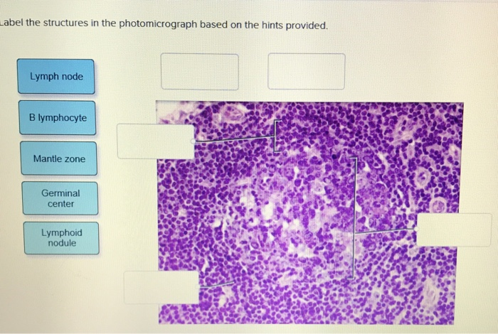 Solved Label the structures in the photomicrograph based on | Chegg.com