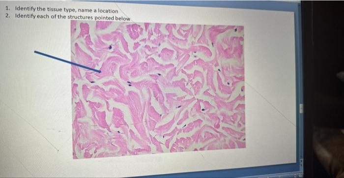 Solved 1. Identify the tissue type, name a location 2. | Chegg.com Solved 1. Identify the tissue type, name a location 2. | Chegg.com
