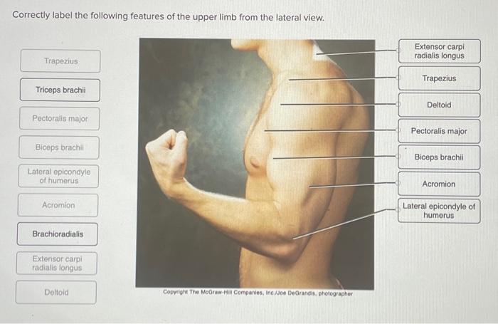 Correctly label the following features of the upper | Chegg.com