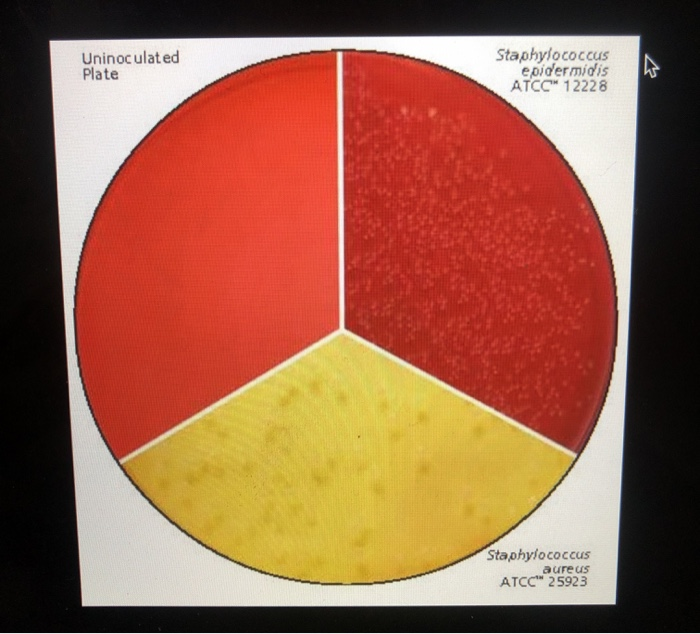 Mannitol Salt Agar Uninoculated