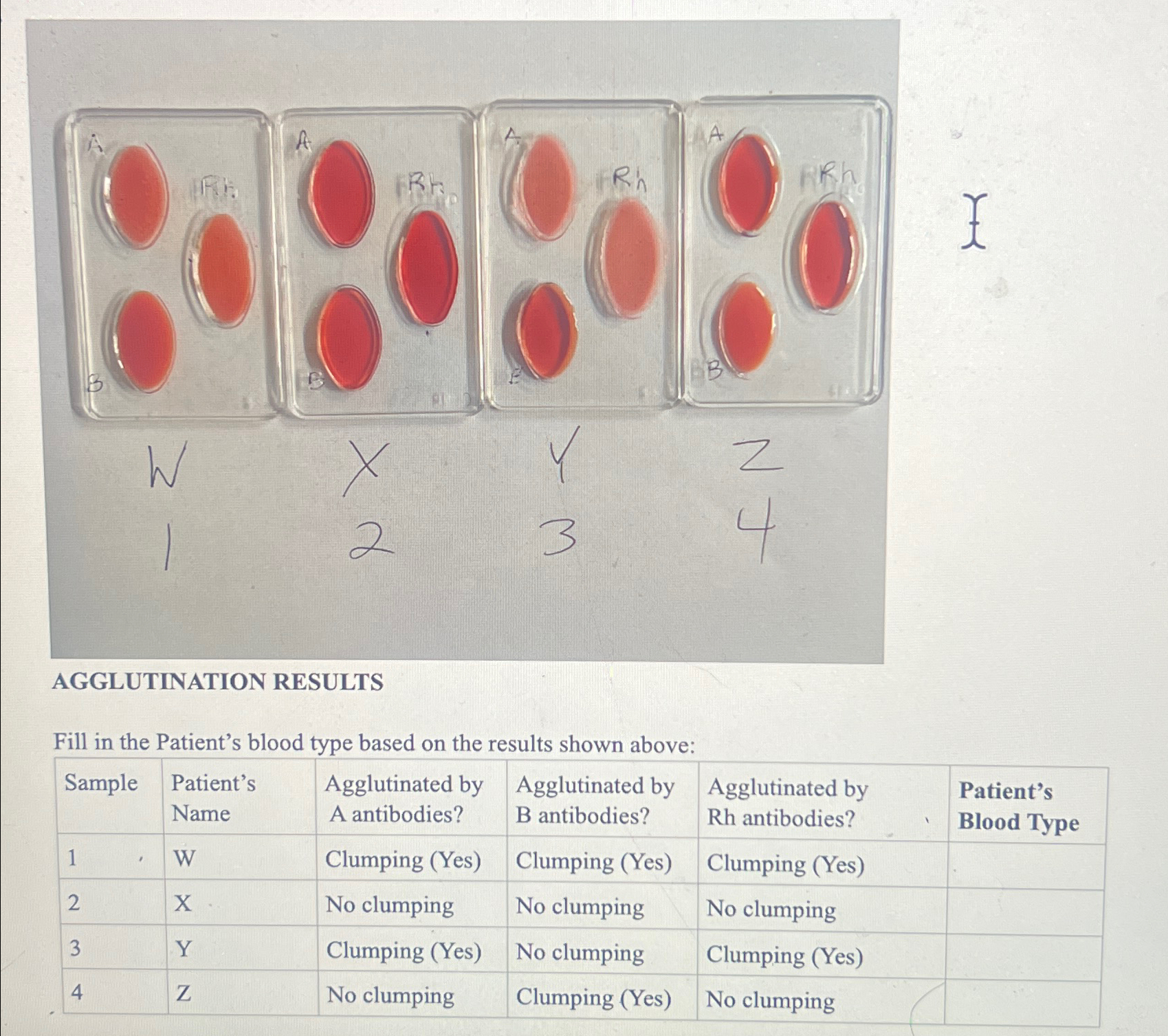Solved Fill in the Patients blood type Patient W-Z | Chegg.com