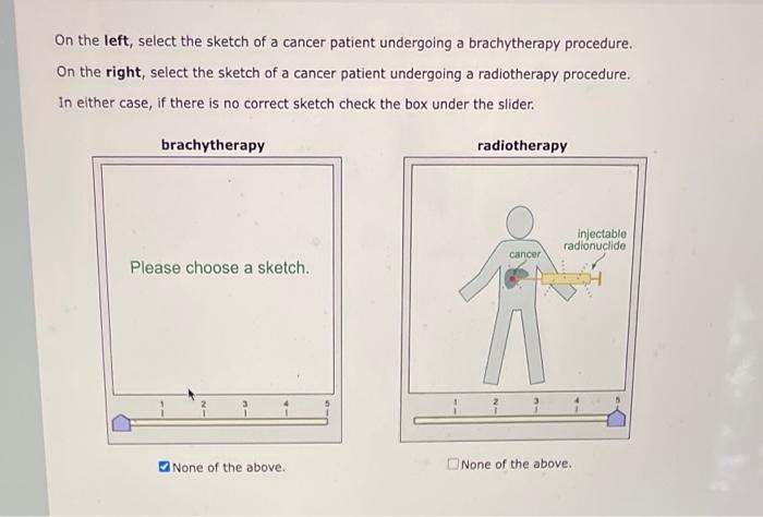 On the left, select the sketch of a cancer patient | Chegg.com