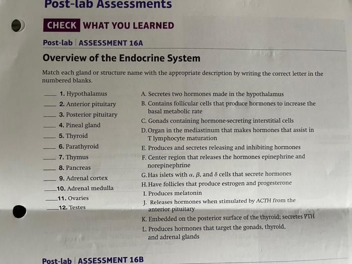 Solved 11. Ovaries 12. Testes J. Releases hormones when | Chegg.com