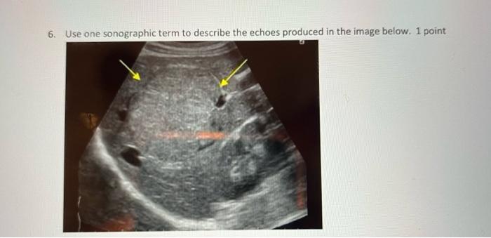Solved sonography terms: anechoic, complex, echogenic, | Chegg.com