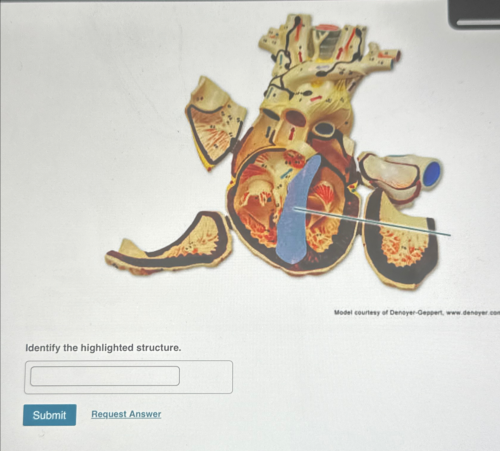 Solved Model courtety of Denoyer-Geppert, www. ﻿denoyer | Chegg.com