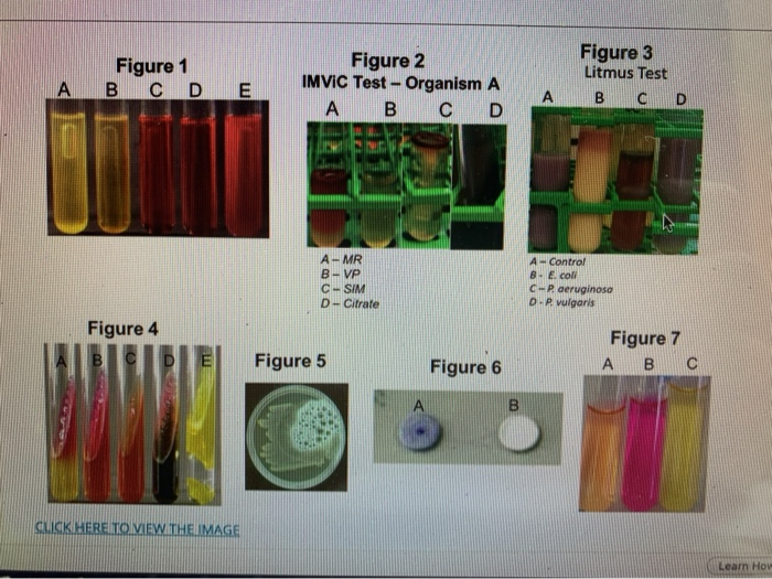 Solved Figure 1 B C D E Figure 2 IMVIC Test - Organism A A B | Chegg.com
