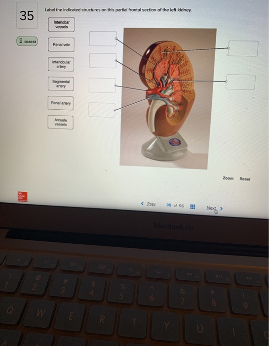 Solved Label the indicated structures on this partial | Chegg.com