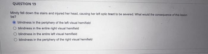 Solved Mindy fell down the stairs and injured her head, | Chegg.com