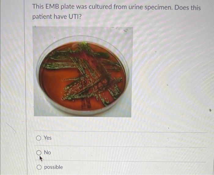Solved This EMB plate was cultured from urine specimen. Does | Chegg.com