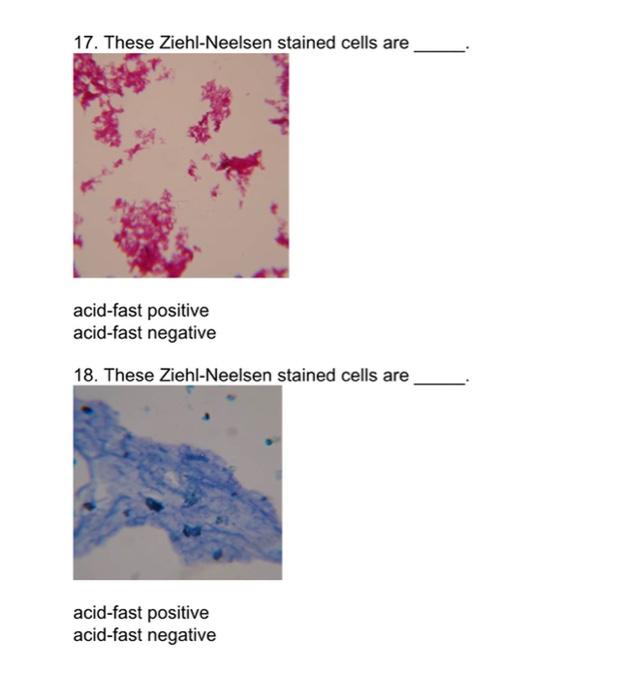 Solved 17. These Ziehl-Neelsen stained cells are acid-fast | Chegg.com