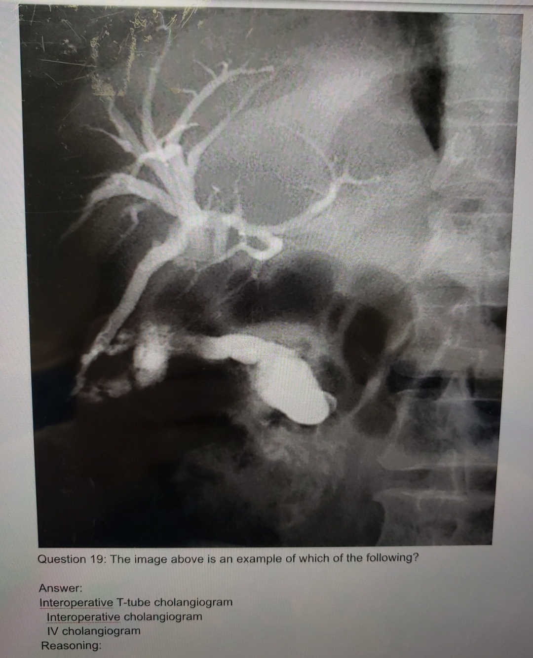 Solved Question 19: The image above is an example of which | Chegg.com