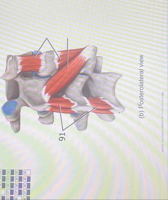 Solved (b) Posterolateral view | Chegg.com
