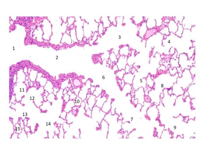 Solved RESPIRATORY SYSTEMA. identify the numbered pointed | Chegg.com