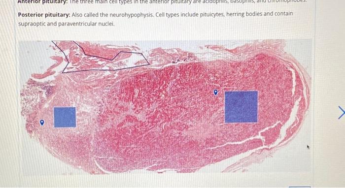 Solved Posterior pituitary: Also called the neurohypophysis. | Chegg.com