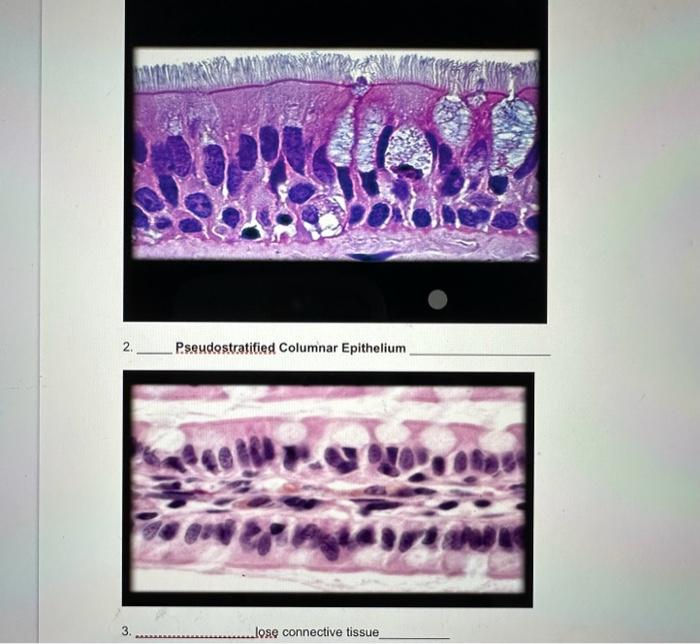 Solved 5. Transitional Epithelium8. cartilage 9. Connective | Chegg.com