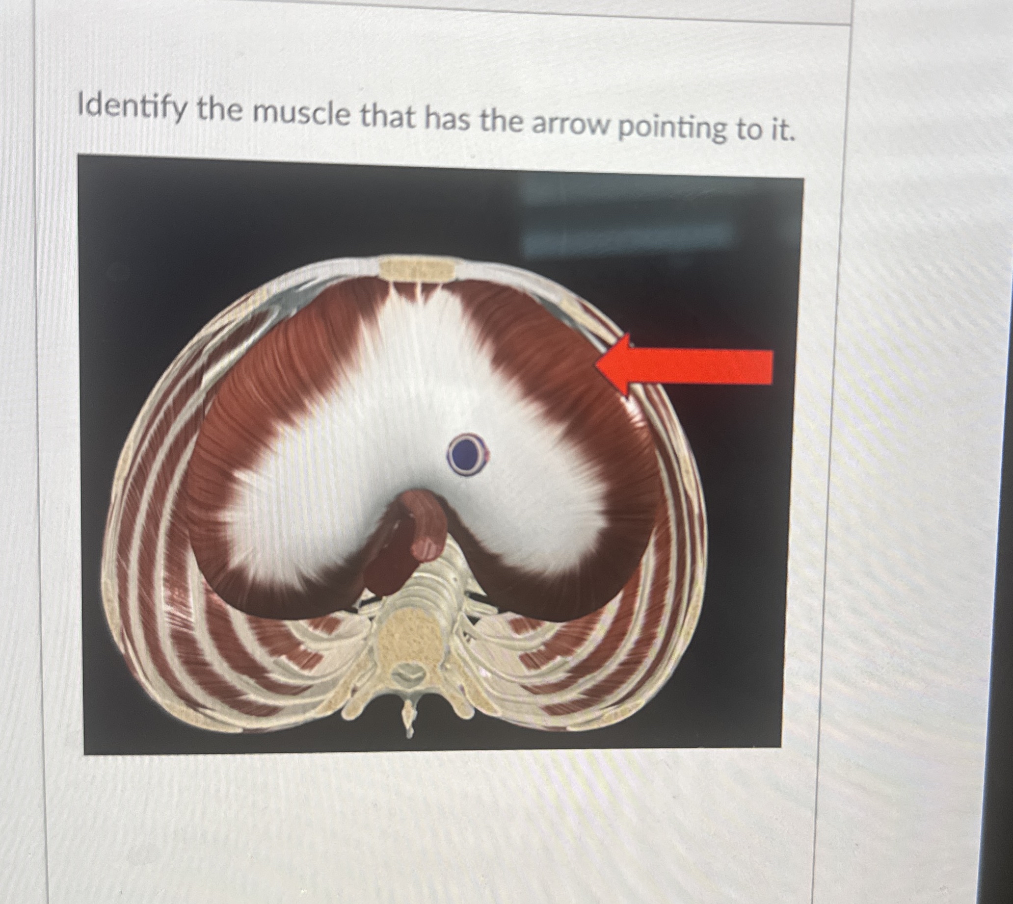 Identify the muscle that has the arrow pointing to | Chegg.com