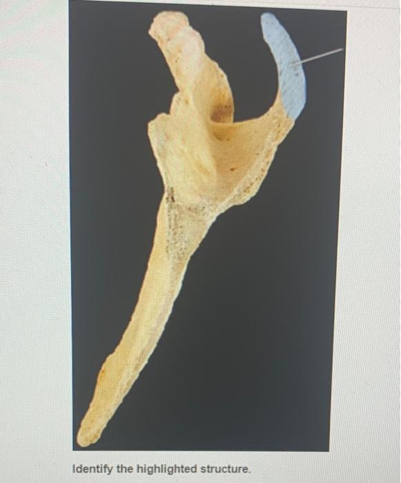 Solved Identify the highlighted structures. Name the type | Chegg.com