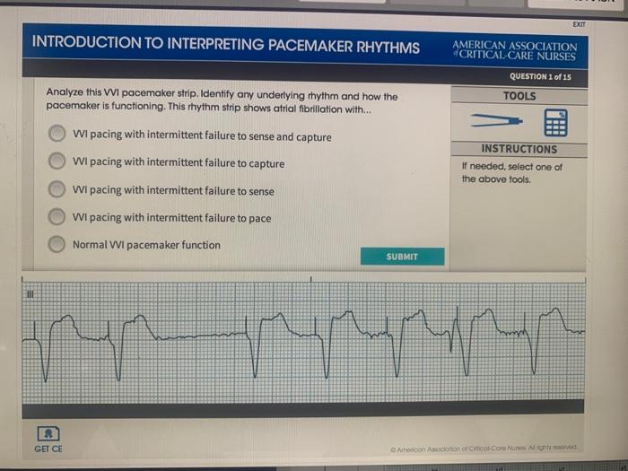 Solved Analyze this VVI pacemaker strip. Identify any | Chegg.com