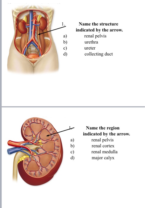 Solved Name the structure indicated by the arrow. renal | Chegg.com