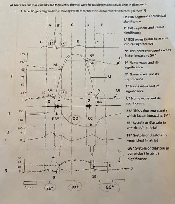 Solved 3 1160 6 Gentr 8ached. [30 POINTS] H∗ EKG segment and | Chegg.com