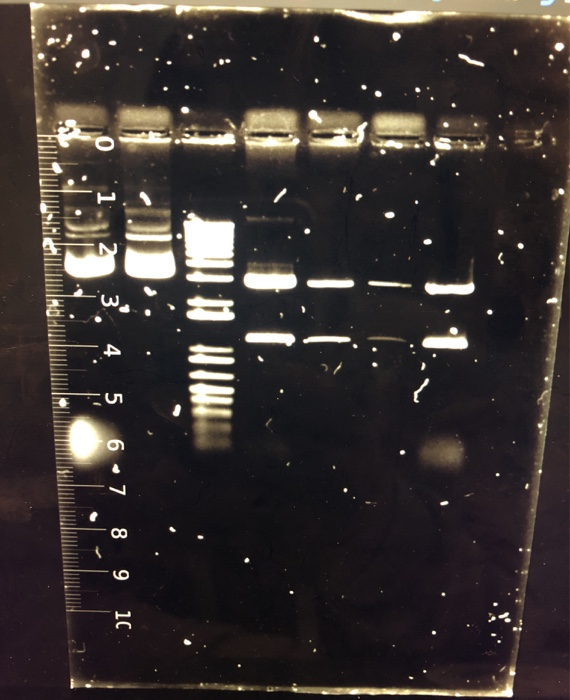 genetics, restrication endonuclease digest of a DNA | Chegg.com