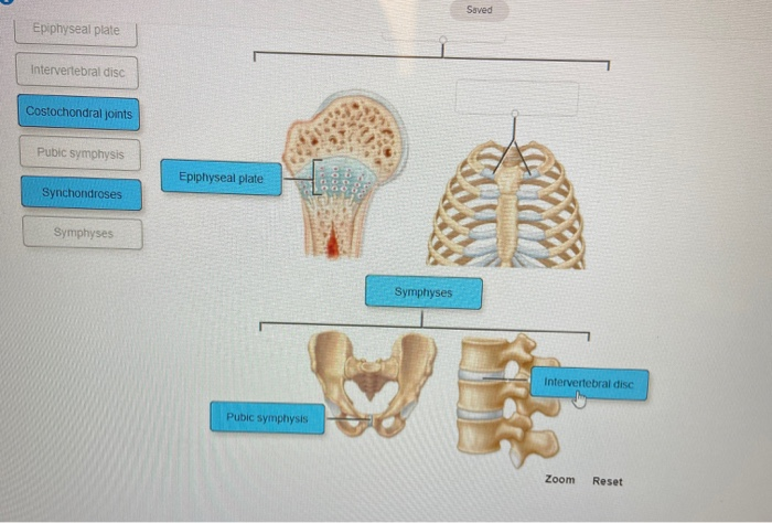 Solved Saved Epiphyseal plate Intervertebral disc | Chegg.com