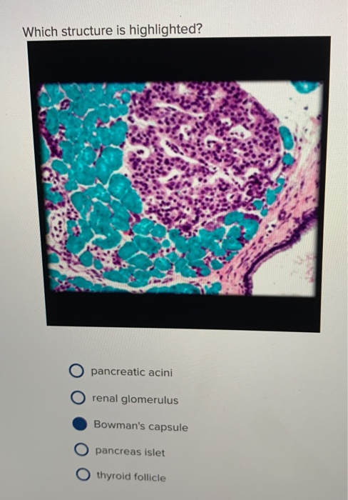 Solved Which structure is highlighted? O thyroid follicle | Chegg.com