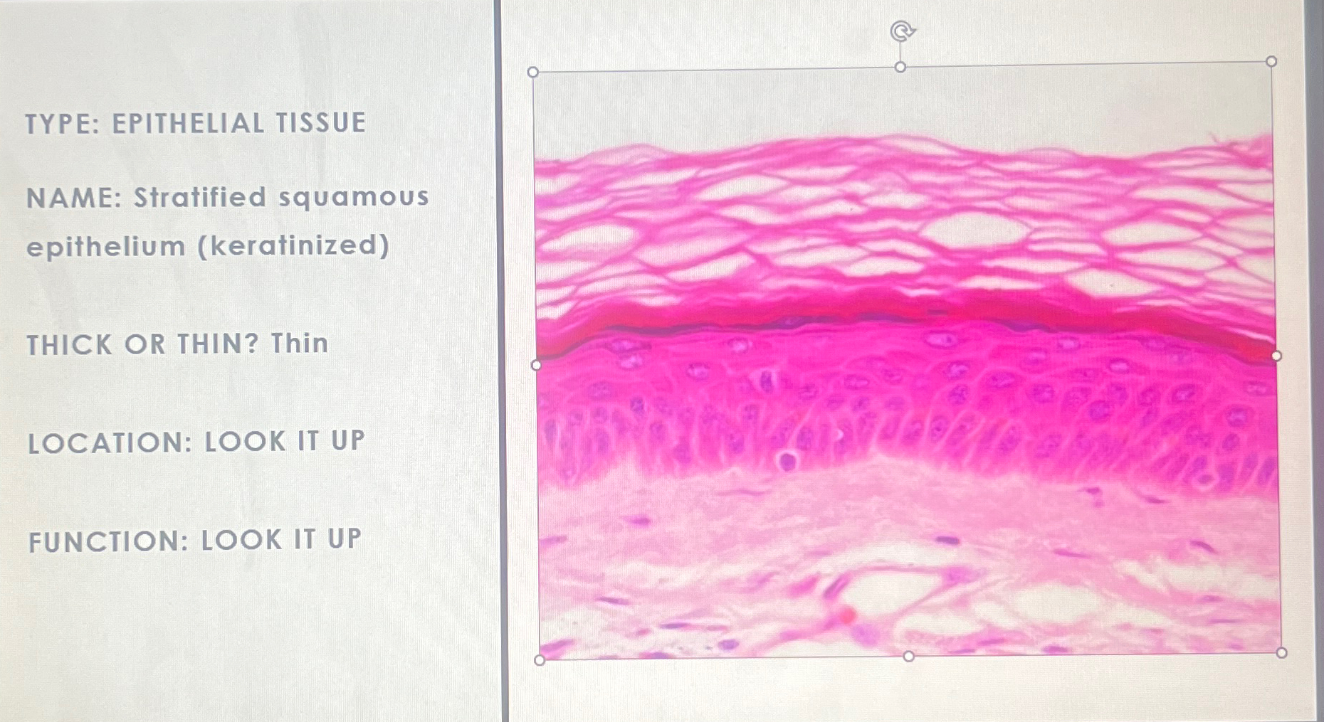 Solved TYPE: EPITHELIAL TISSUENAME: Stratified squamous | Chegg.com