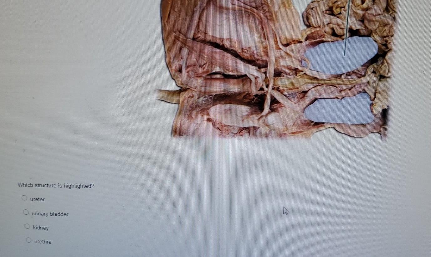 Solved Which structure is highlighted? ureter urinary | Chegg.com
