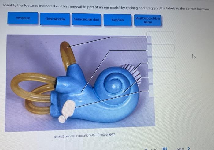 Solved Identify the features indicated on this removable | Chegg.com