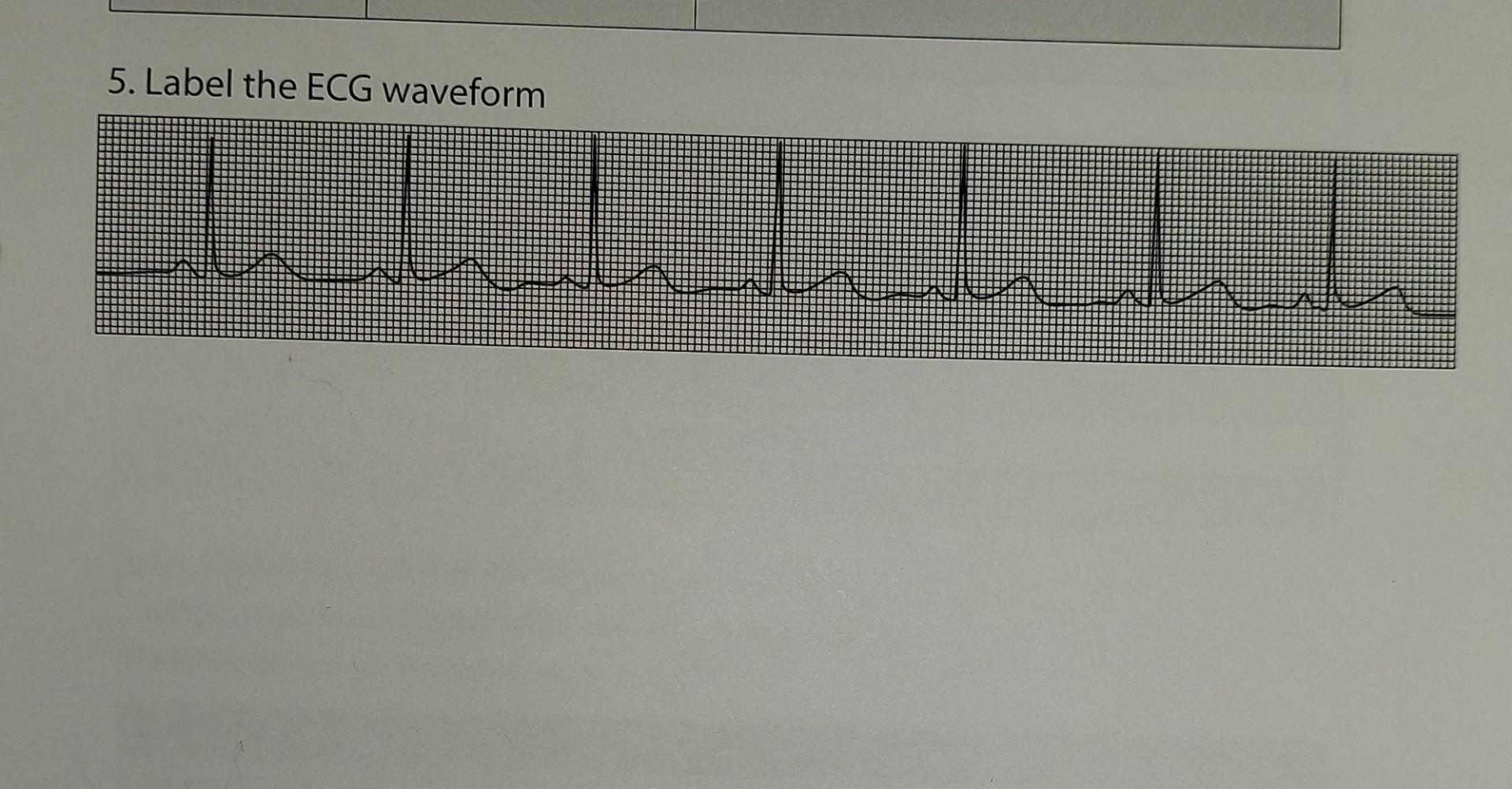 Solved 5. Label the ECG waveform | Chegg.com