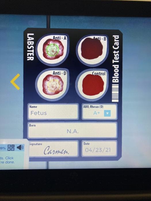 Solved Anti-A LABSTER Idilli Blood Test Card Anti-D Control | Chegg.com