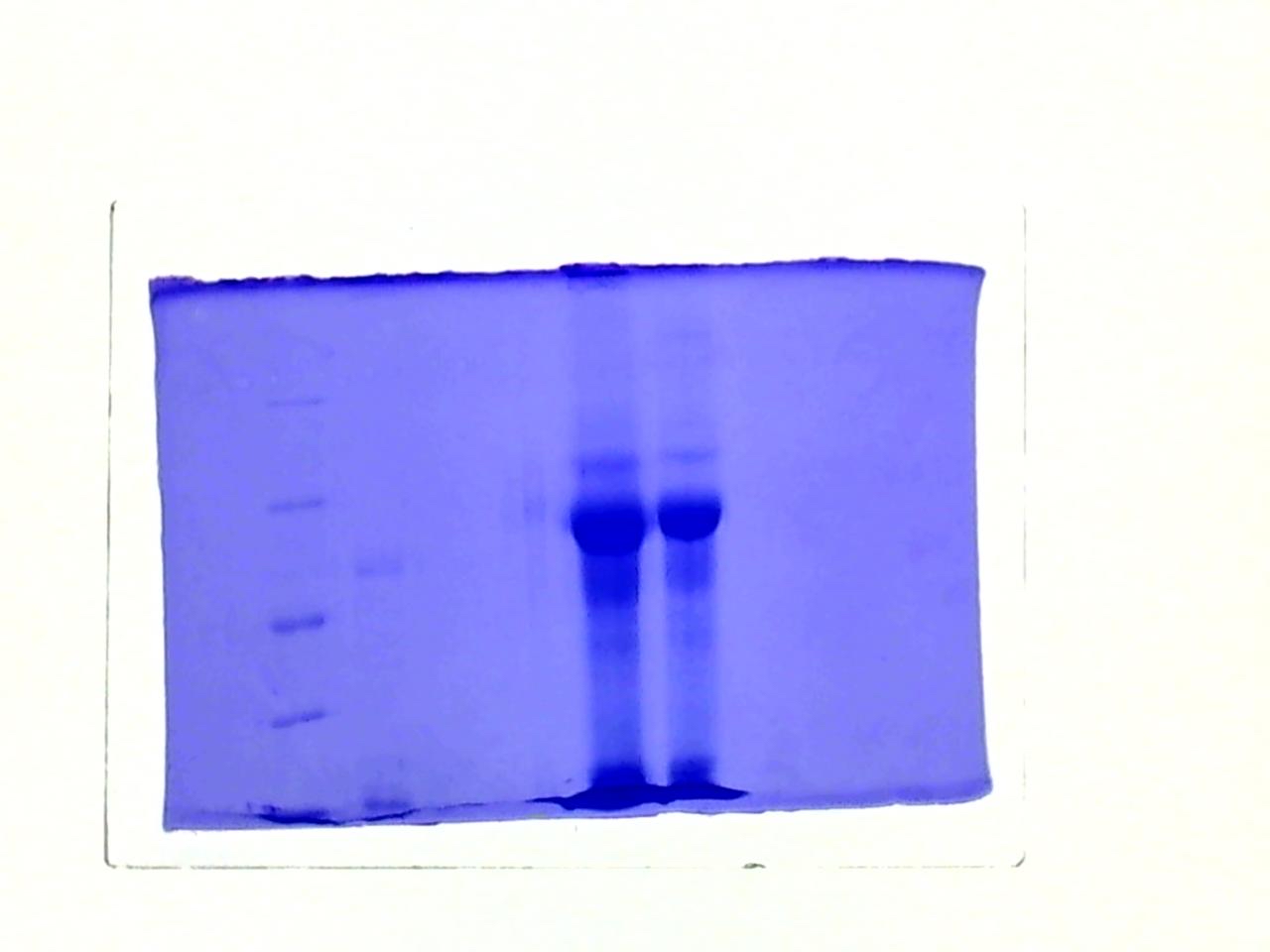 Solved Label this image as light chains and heavy chains | Chegg.com