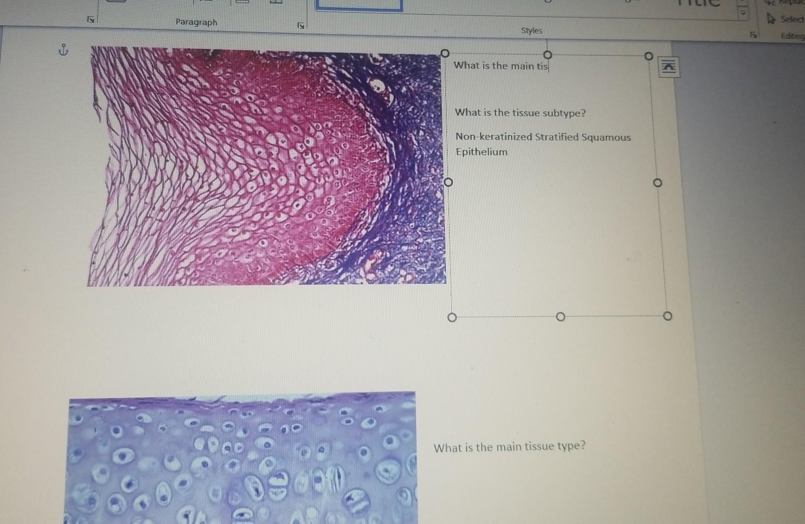 Solved What is the main tissue type? What is the main | Chegg.com