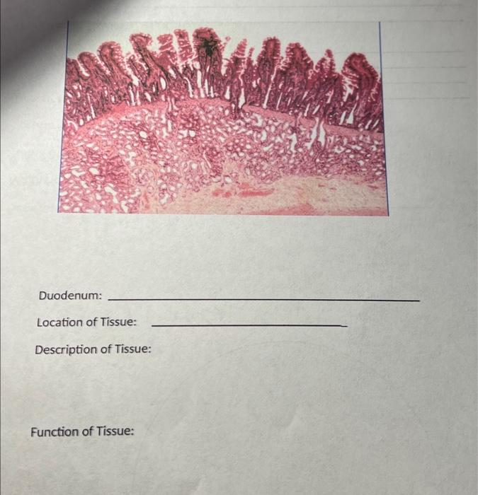 Solved Duodenum: Location of Tissue: Description of Tissue: | Chegg.com