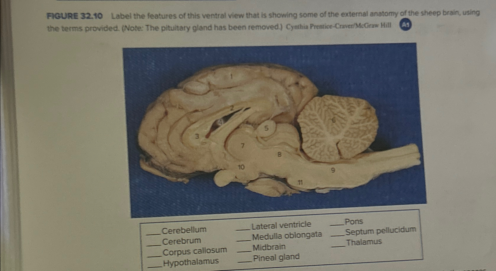 Solved FGGURE 32.10 ﻿Label the features of this ventral view | Chegg.com