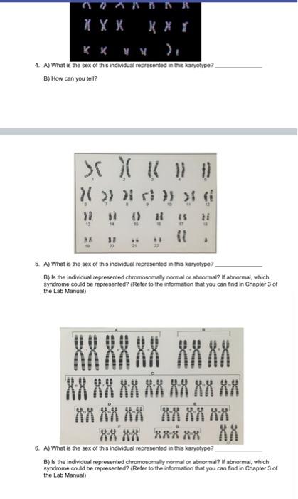 Solved Chromosome Activity Sheet vvv MA 00 (00 1. A) What | Chegg.com