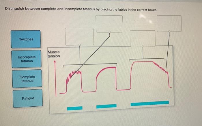 Solved Distinguish between complete and incomplete tetanus | Chegg.com Solved Distinguish between complete and incomplete tetanus | Chegg.com