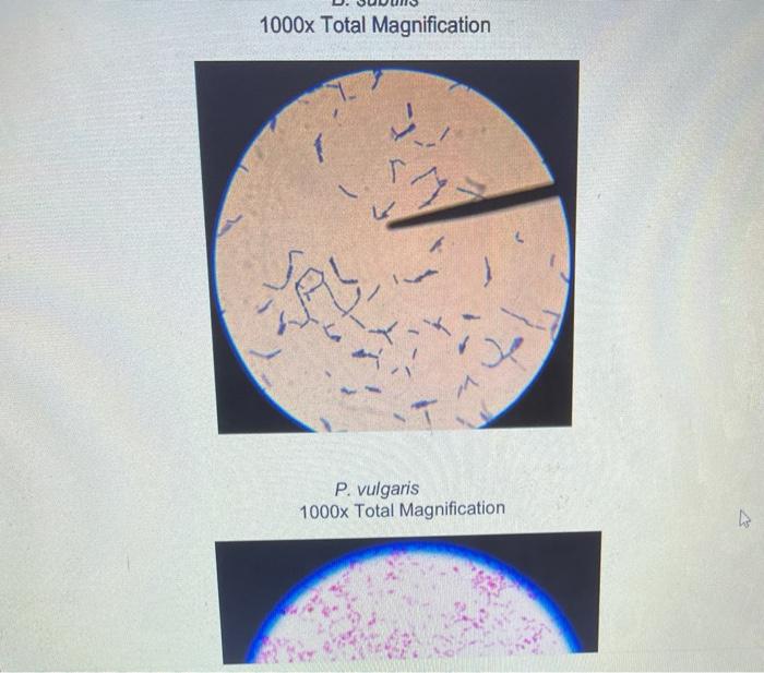Proteus Vulgaris Gram Stain 1000x