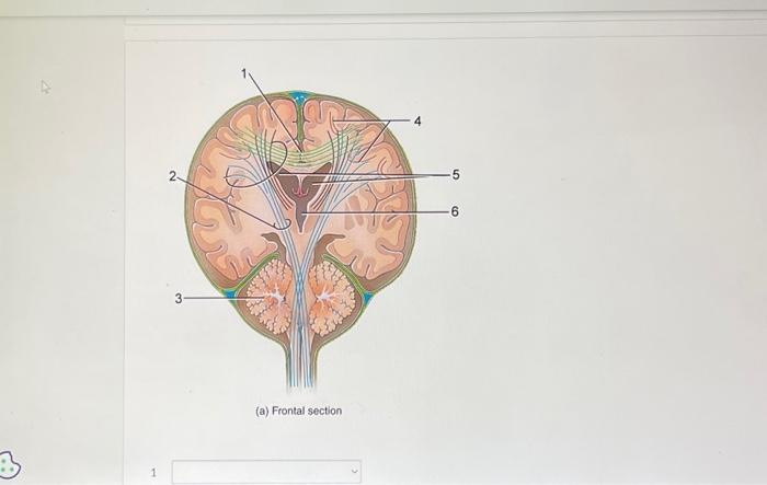 Solved (a) Frontal section | Chegg.com