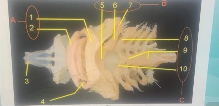Solved 1. The Squalus Skeleton: answer the following | Chegg.com
