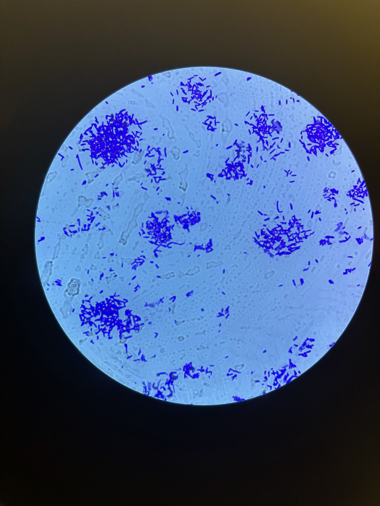 Solved Insert an image of your gram stain smear.Label on | Chegg.com