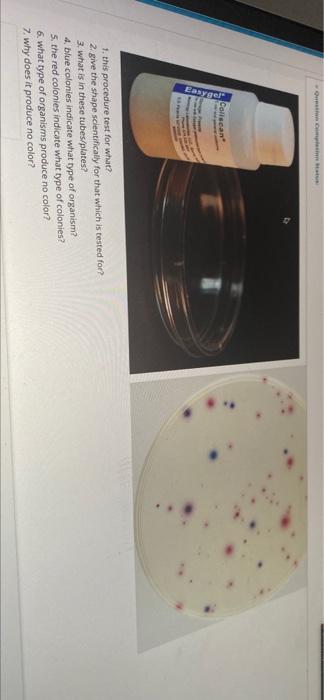 Solved Our Collscan Easygel 1. this procedure test for what? | Chegg.com