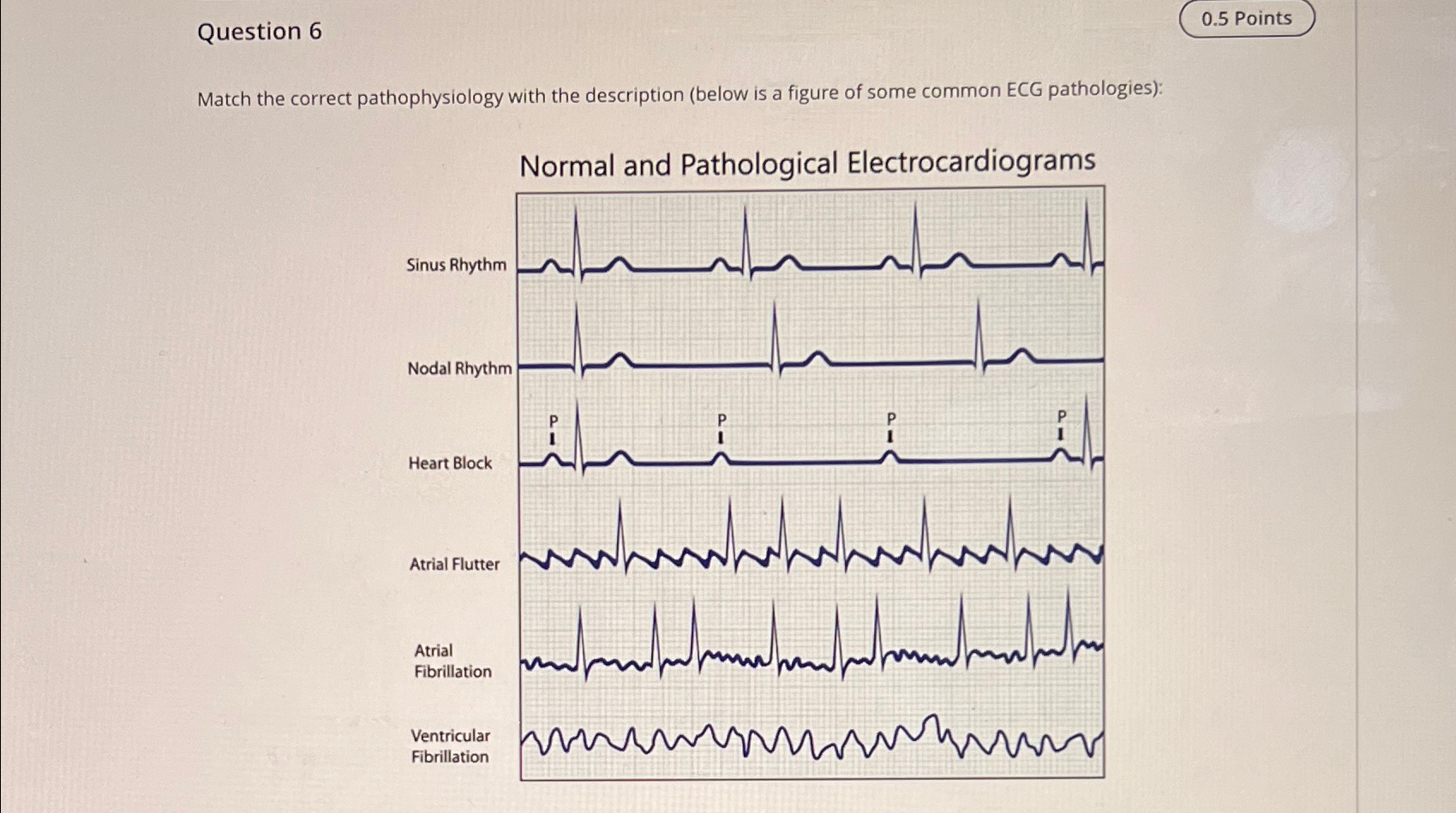 Question 6Match the correct pathophysiology with the | Chegg.com