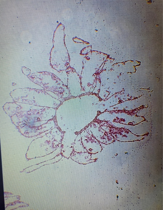 Solved label the diagramgrantia sycon cross | Chegg.com