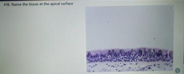 Solved Name the tissue at the apical surface | Chegg.com