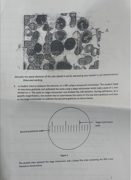 Solved Magnification and Micrometry (Practical exercise) The | Chegg.com